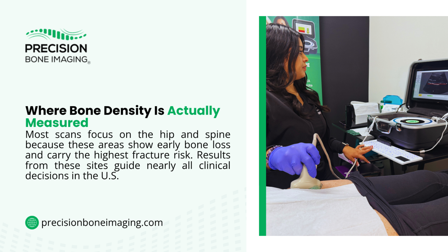 Bone Density Scan Results Explained: A Full 2026 Guide